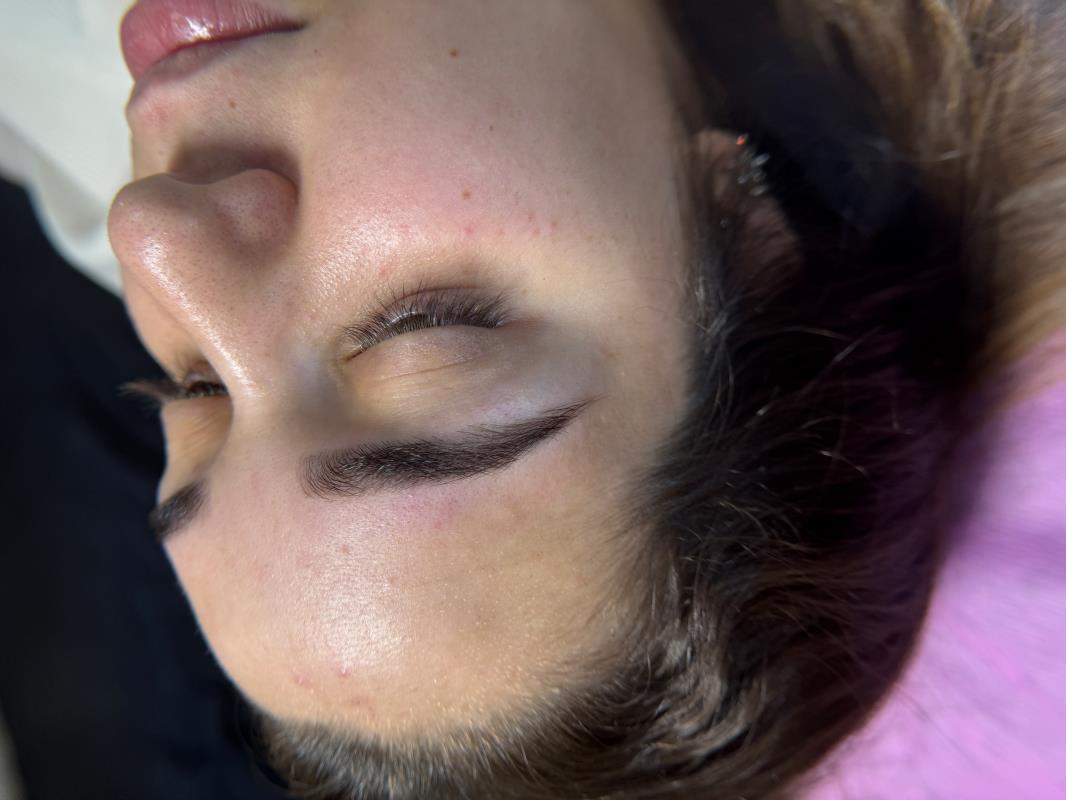 Calmark - ליאל קוסמטיקס